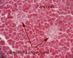 Stranded on the Islets of Langerhans | Another Think
